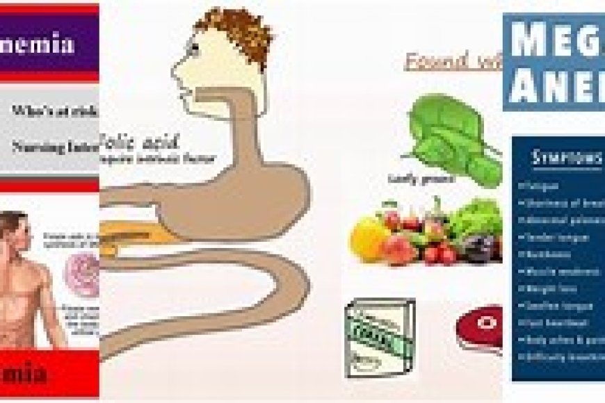 Folic Acid Deficiency Anemia - Khichdi Network Portal
