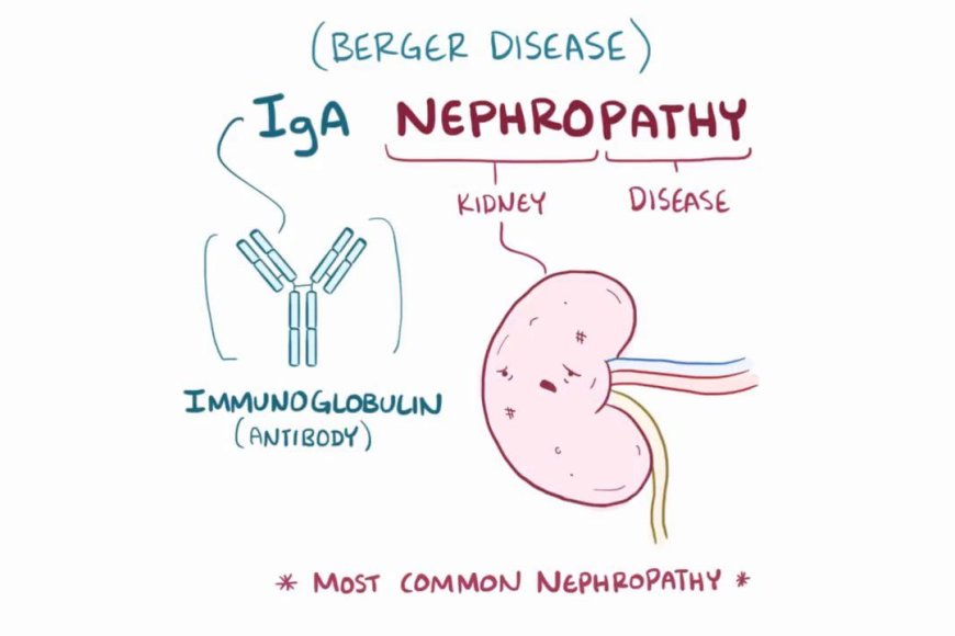 IgA Nephropathy - Khichdi Network Portal